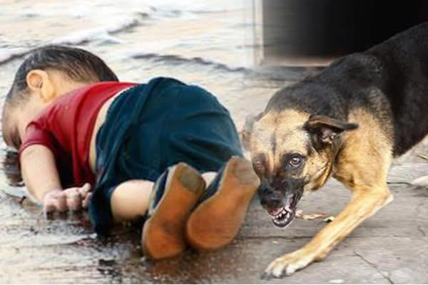 Бага насны хүүхэд нохойд хазуулж гэмтжээ